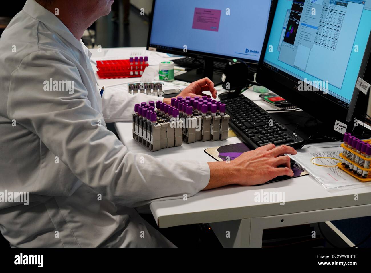 Technical platform of the Inovie 34 laboratory . Validation of results, NFS, blood count and VS ...