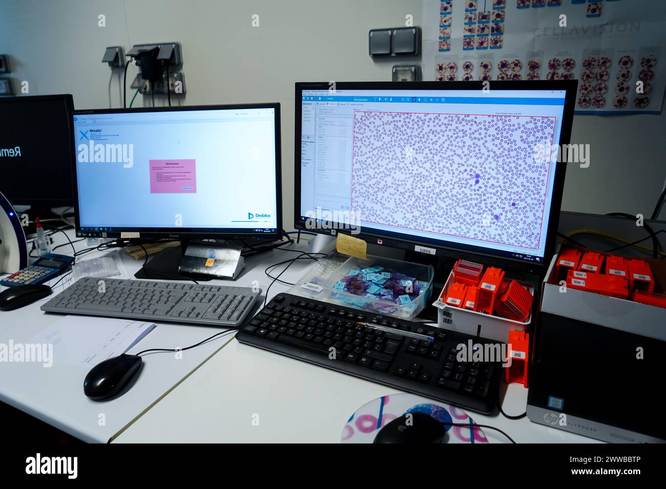 Technical platform of the Inovie 34 laboratory . Digitized optical microscope for the ...