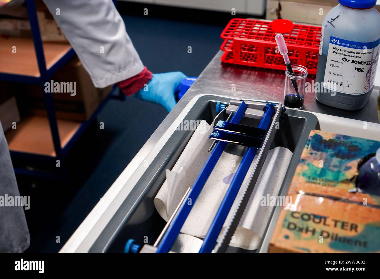 Technical platform of the Inovie 34 laboratory . Staining of a malaria ...