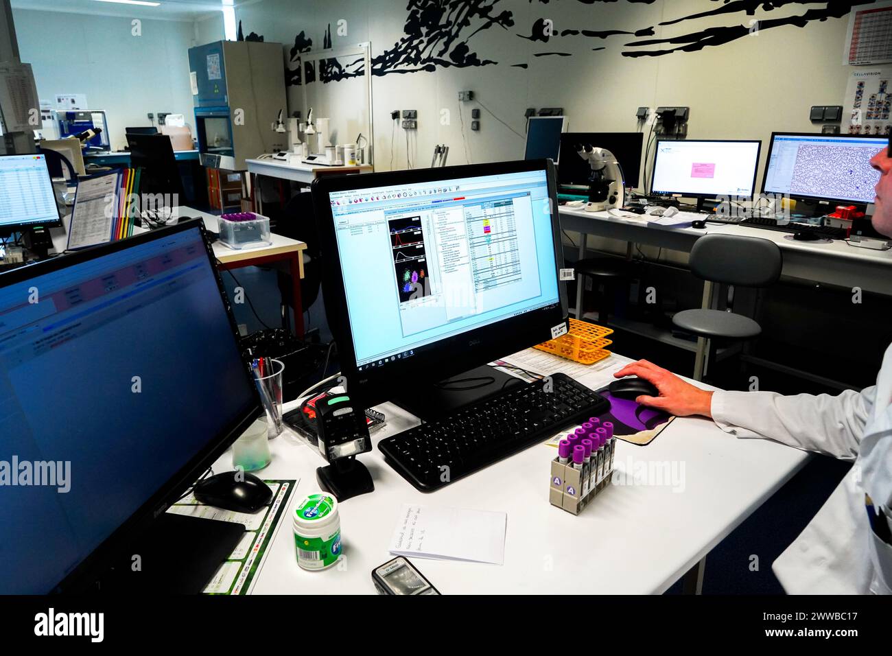 Technical platform of the Inovie 34 laboratory . Validation of NFS results, blood count Stock ...