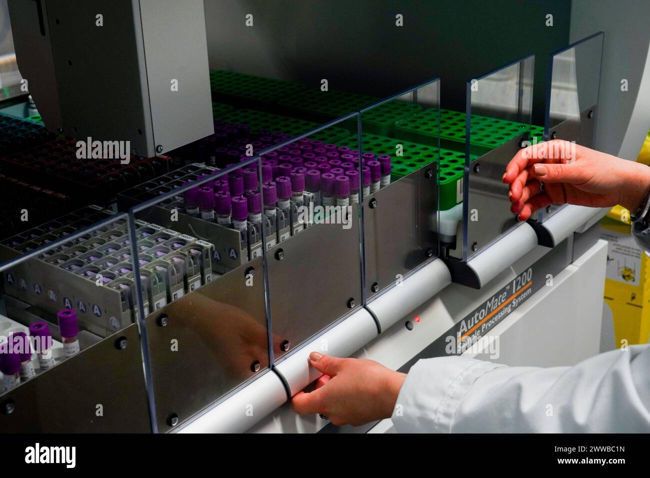 Technical platform of the Inovie 34 laboratory . Hematology tube sorter. NFS, blood count, VS ...