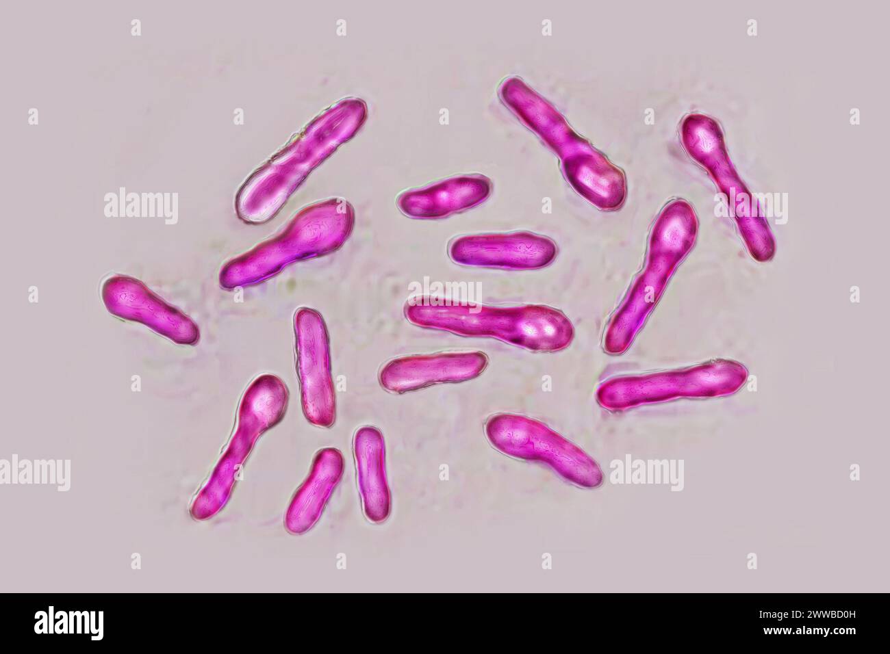 Clostridium Botulinum Bacteria