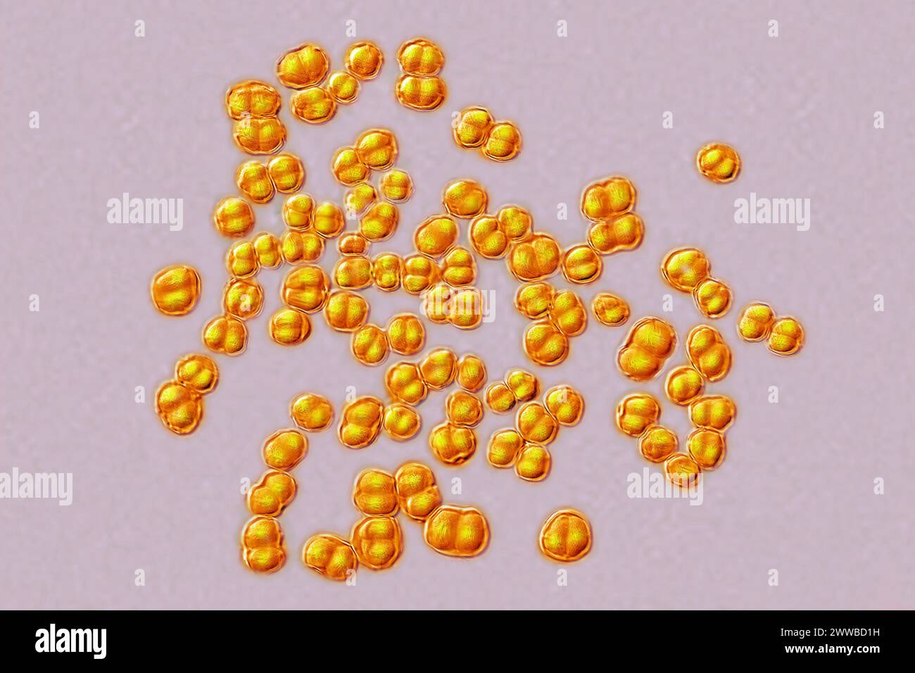 Meningococcus or meningococcal disease or Neisseria meningitidis, is a ...
