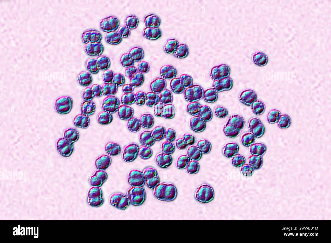 Meningococcal disease hi-res stock photography and images - Alamy