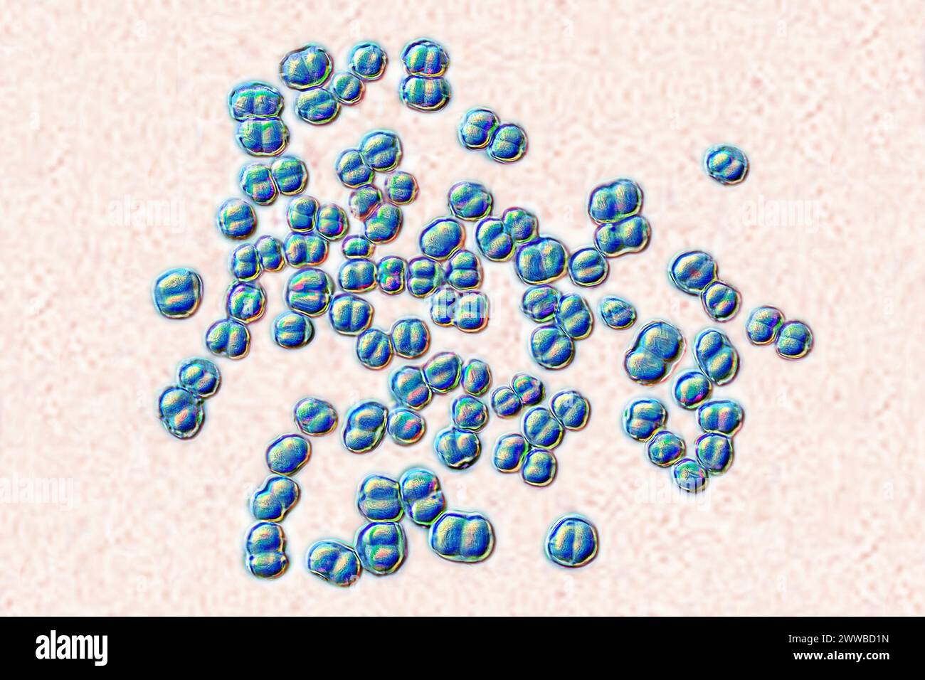 Meningococcus or meningococcal disease or Neisseria meningitidis, is a ...