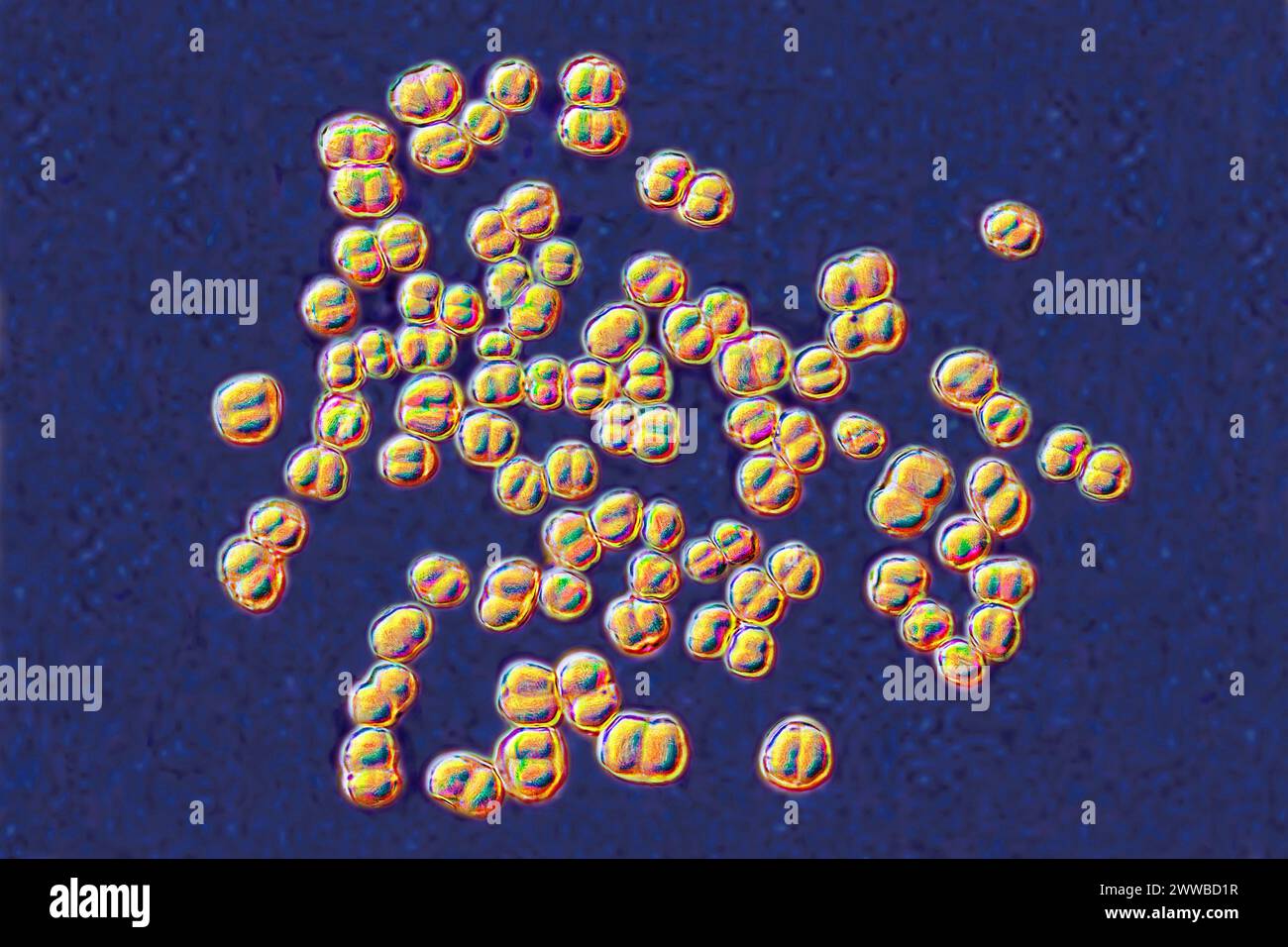 Meningococcus or meningococcal disease or Neisseria meningitidis, is a ...