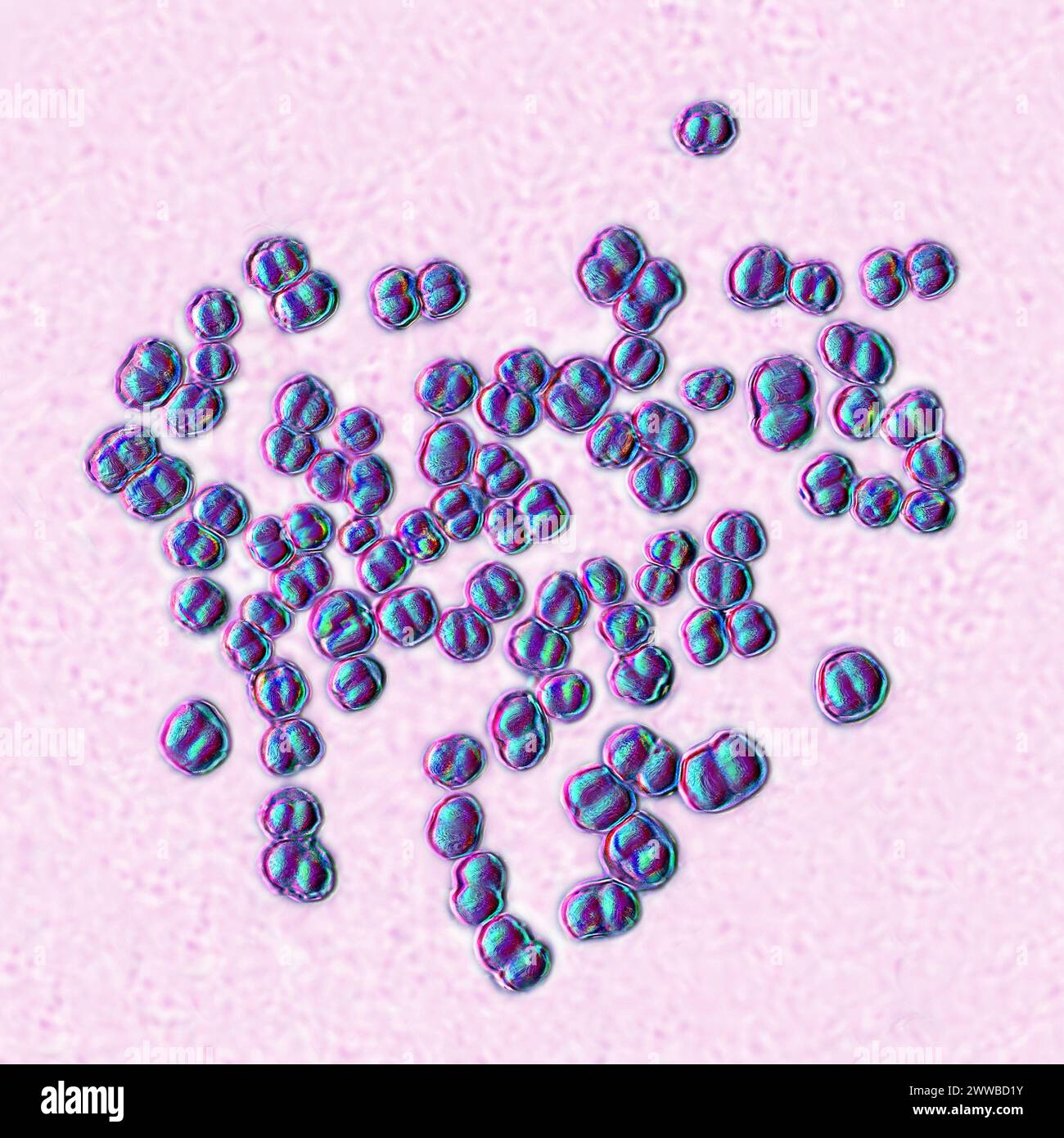 Neisseria meningitidis hi-res stock photography and images - Alamy