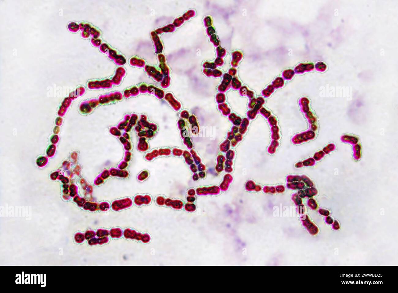 Group A streptococci pyogenes. It is the cause of skin infections ...