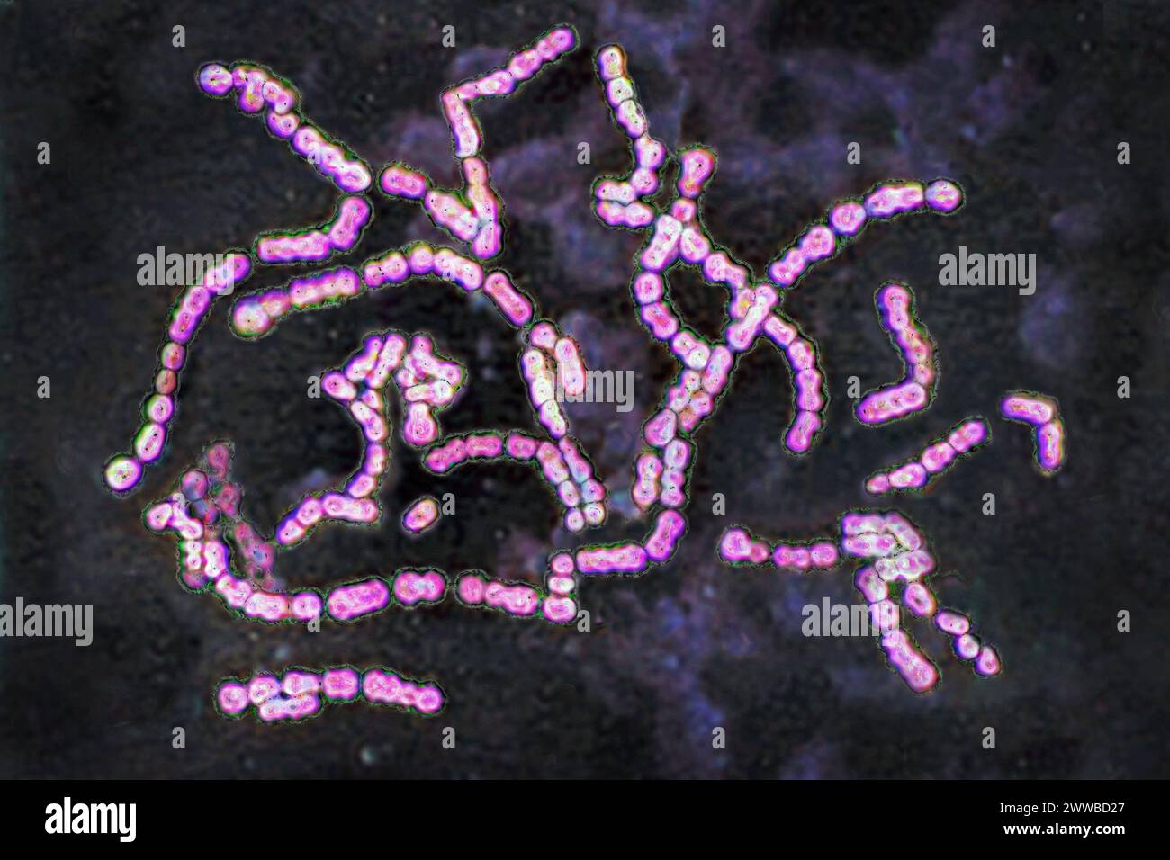 Group A streptococci pyogenes. It is the cause of skin infections ...