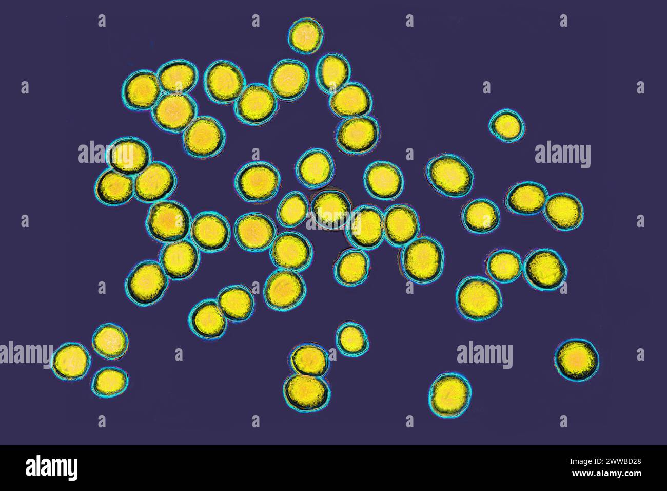 Staphylococci (Staphylococcus pyogenes aureus), bacteria responsible ...