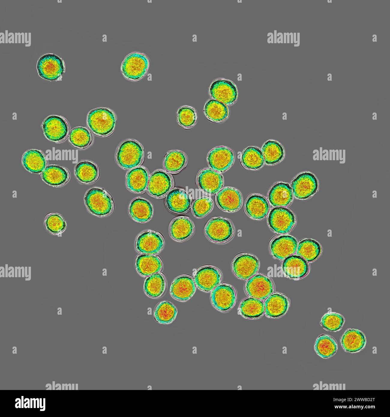 Staphylococci (Staphylococcus pyogenes aureus), bacteria responsible ...