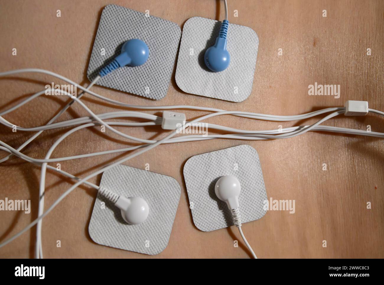 Mature woman getting electrical stimulation therapy on body Stock Photo ...