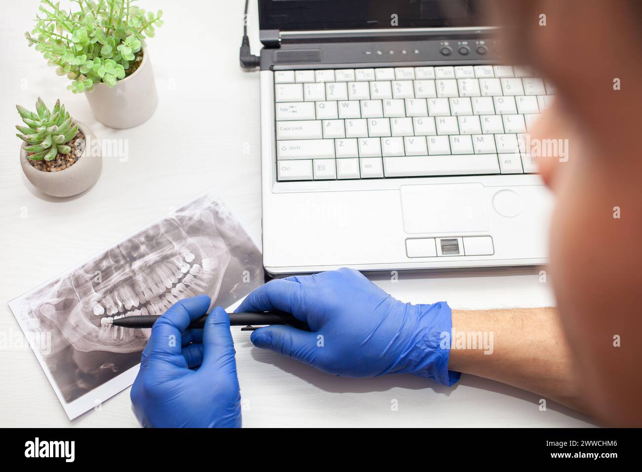 The dentist in clinic examines x-ray of jaw of client's patient's teeth ...