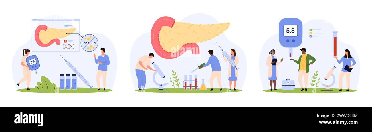 Pancreas checkup, diabetes set. Tiny people check endocrine gland ...