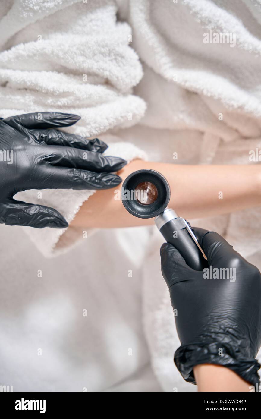 Top cropped view of cosmetologist examining hand skin with dermatoscope ...