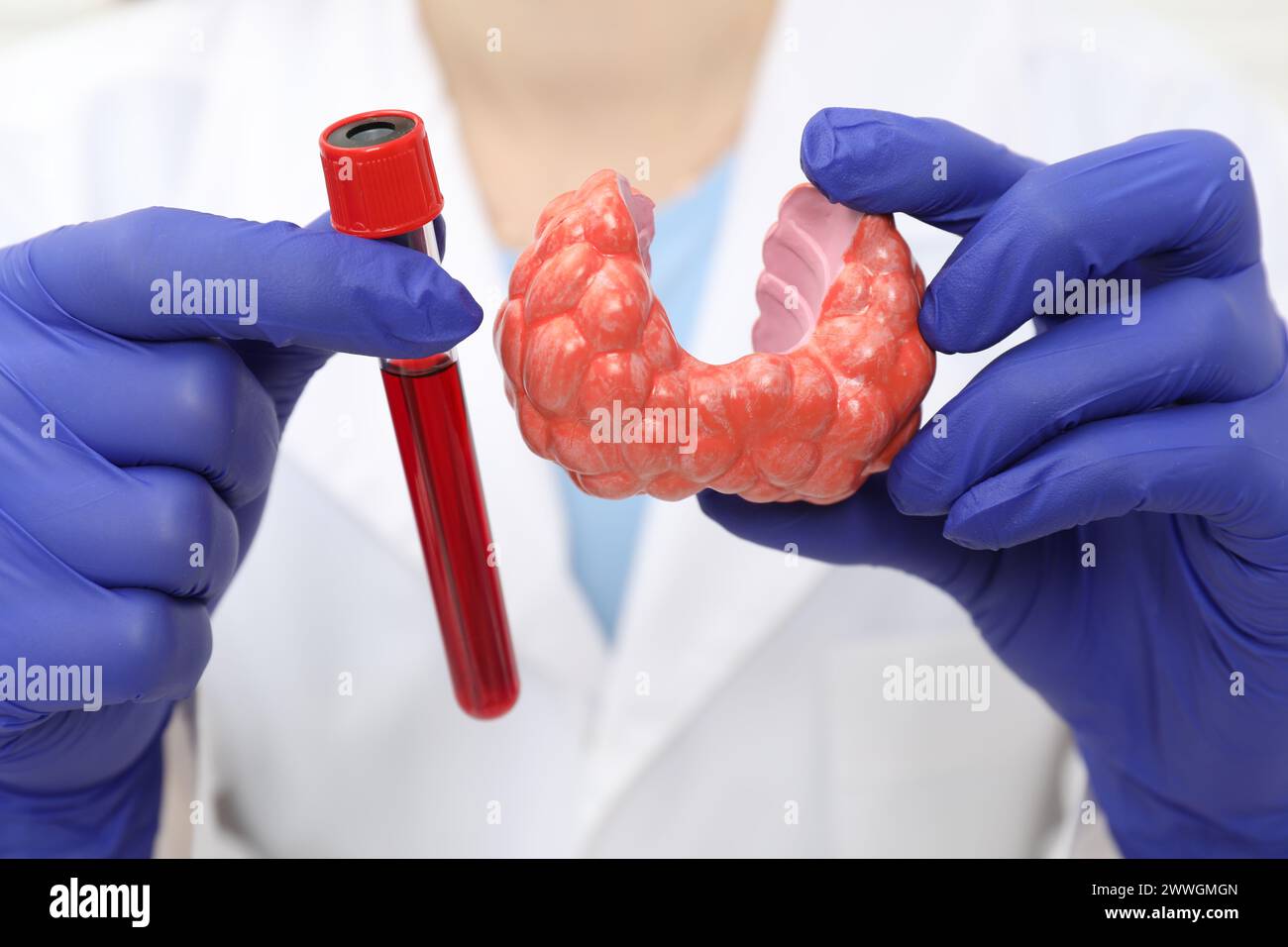 Endocrinologist showing thyroid gland model and blood sample in test ...