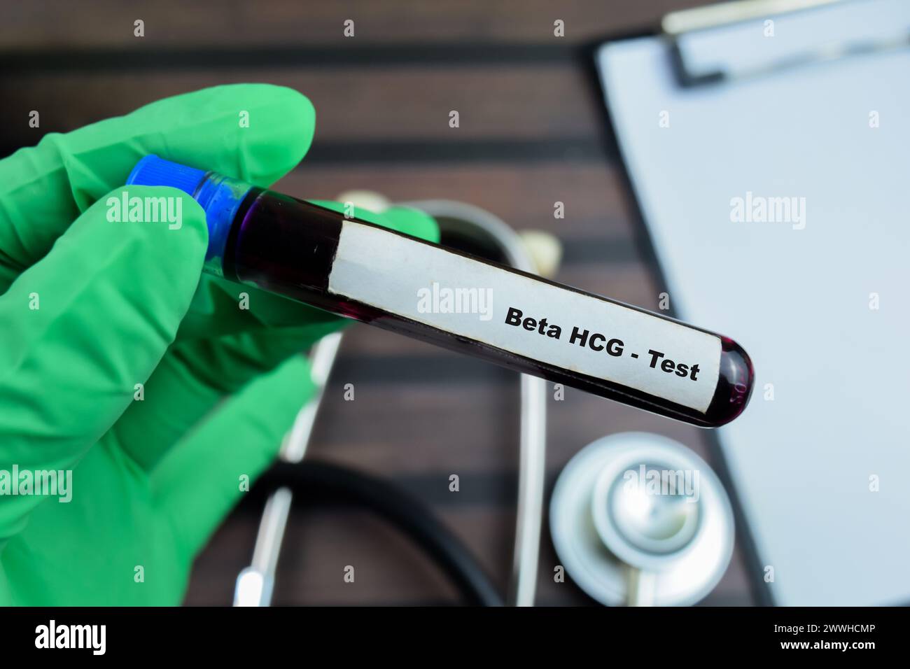 Hcg hi-res stock photography and images - Alamy