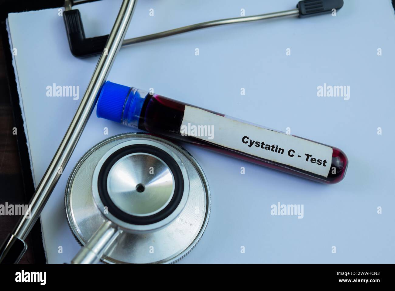 Cystatin C - Test with blood sample on wooden background. Healthcare or ...