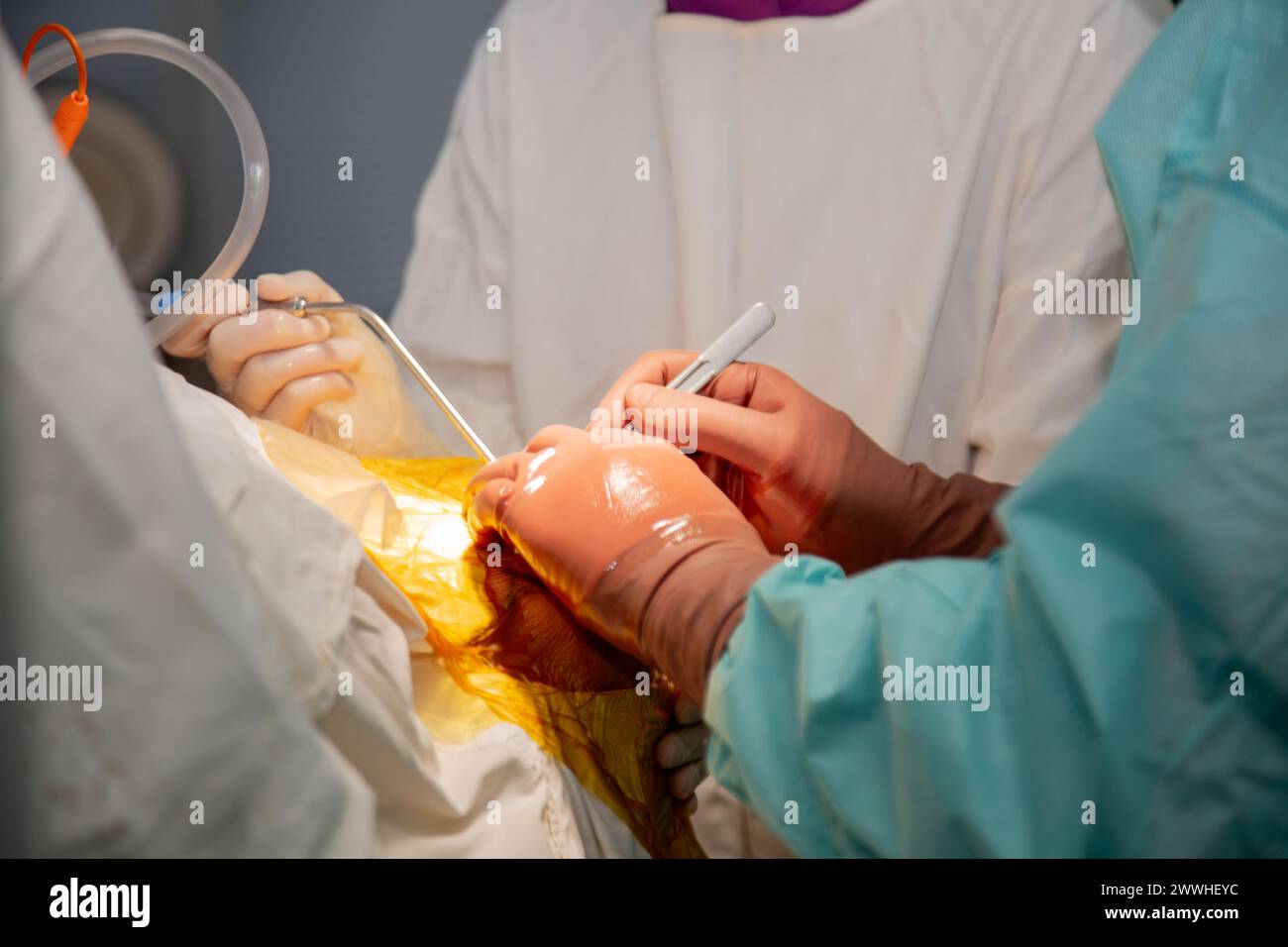 Surgeons perform an operation. Real photos from the operation Stock ...