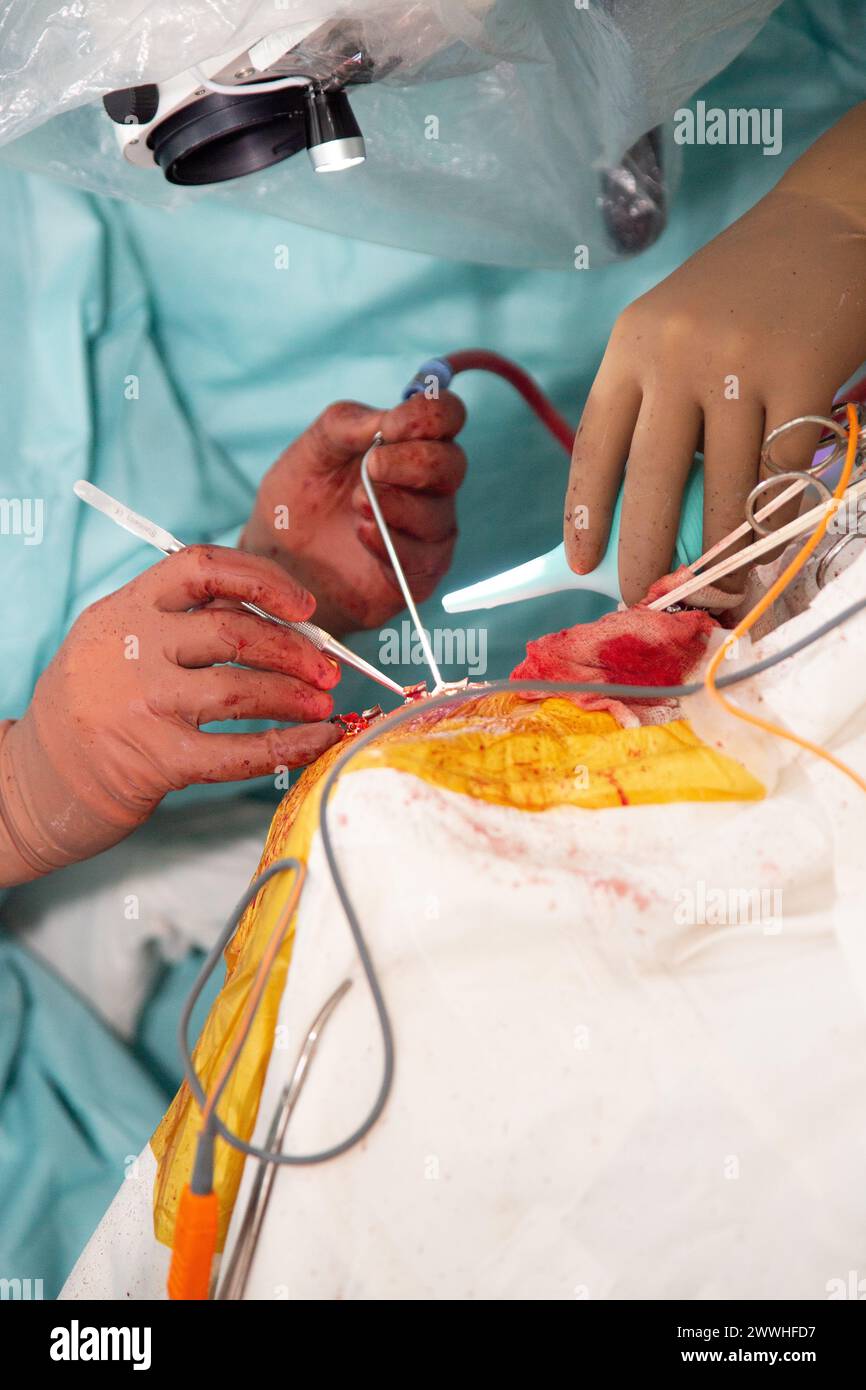 Surgeons perform an operation. Real photos from the operation Stock ...