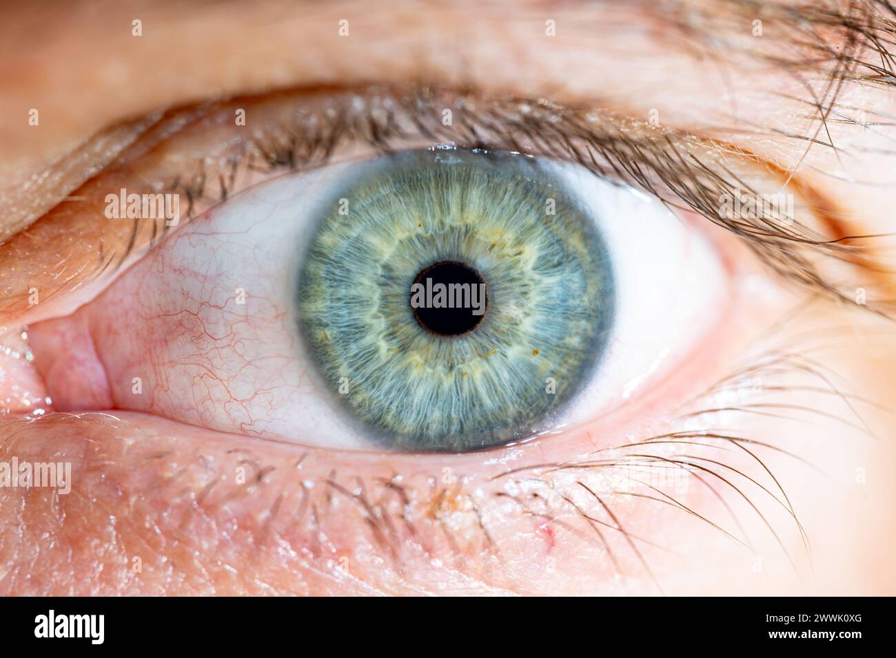 Description: Male Blue-Green Colored Eye With Lashes. Pupil closed ...