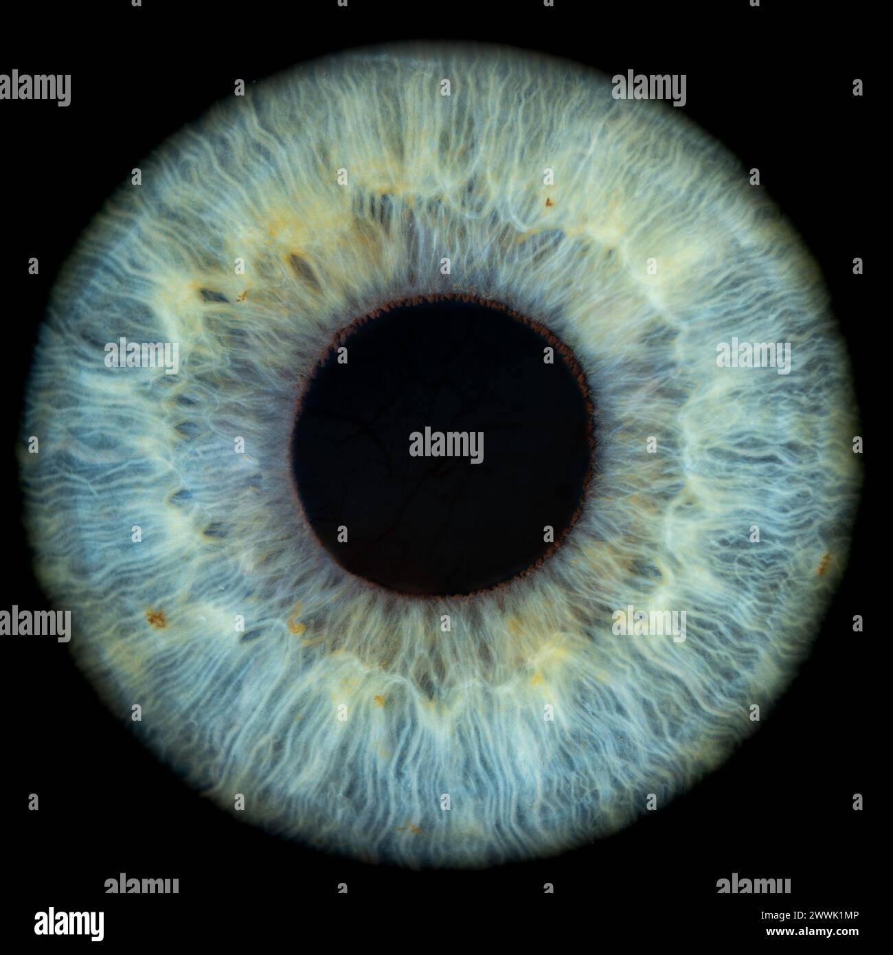 Description: High magnification of Male Blue-Green Colored Eye With ...