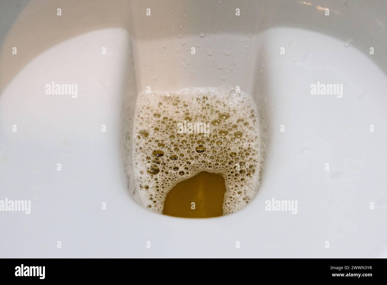 Closeup on yellowish urine with bubble in toilet bowl Stock Photo - Alamy