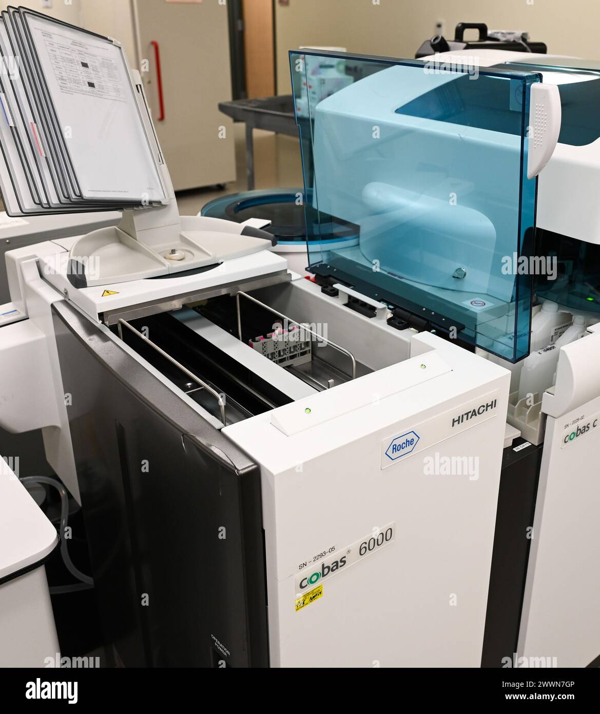 A hemoglobin A1C sample is processing on the chemistry analyzer in the ...