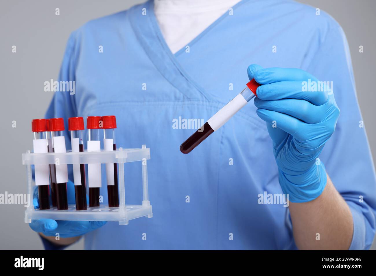 Laboratory testing. Doctor with blood samples in tubes on light grey ...