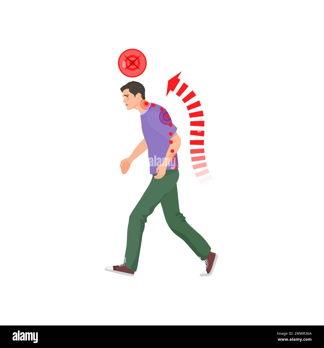 Walking man in wrong spine posture. Spine problems, bad walking pose ...