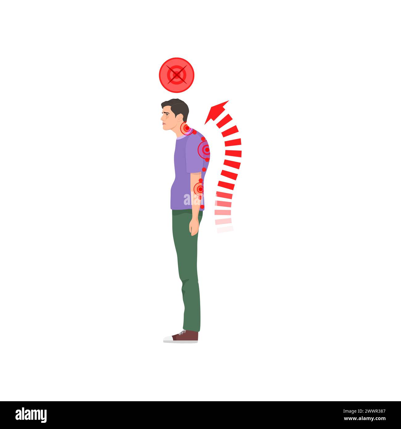 Standing man with incorrect spine posture. Spine health, bad body pose ...