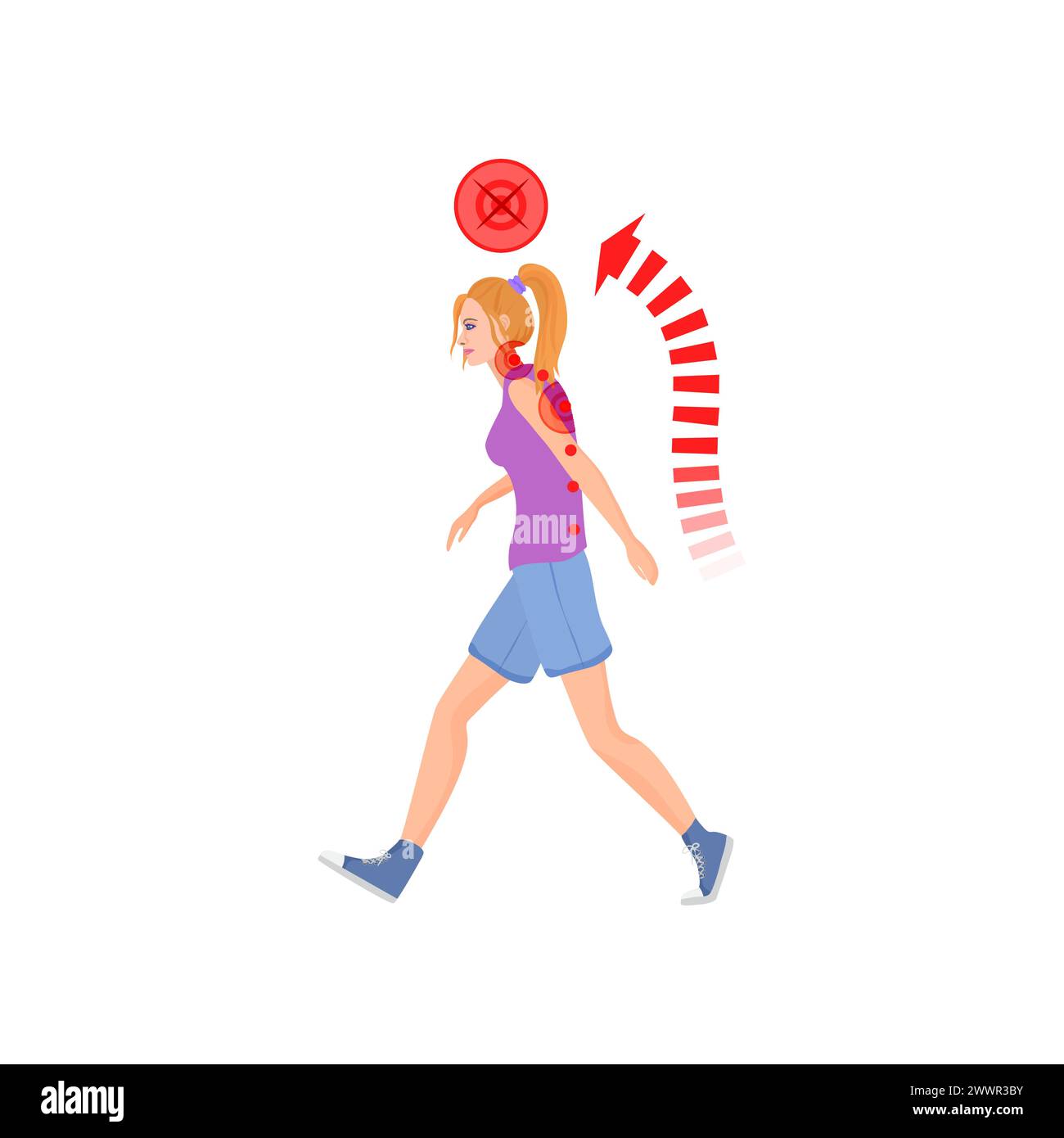 Walking woman in wrong spine posture. Spine health, bad walking pose ...
