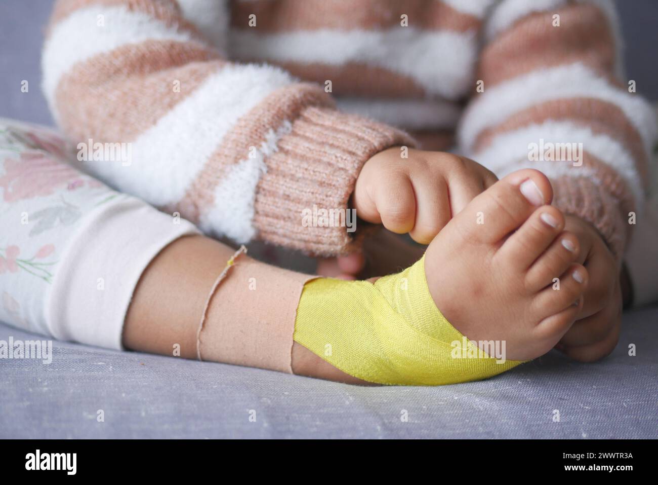 Elastic therapeutic yellow tape applied to child leg. Kinesio Taping ...