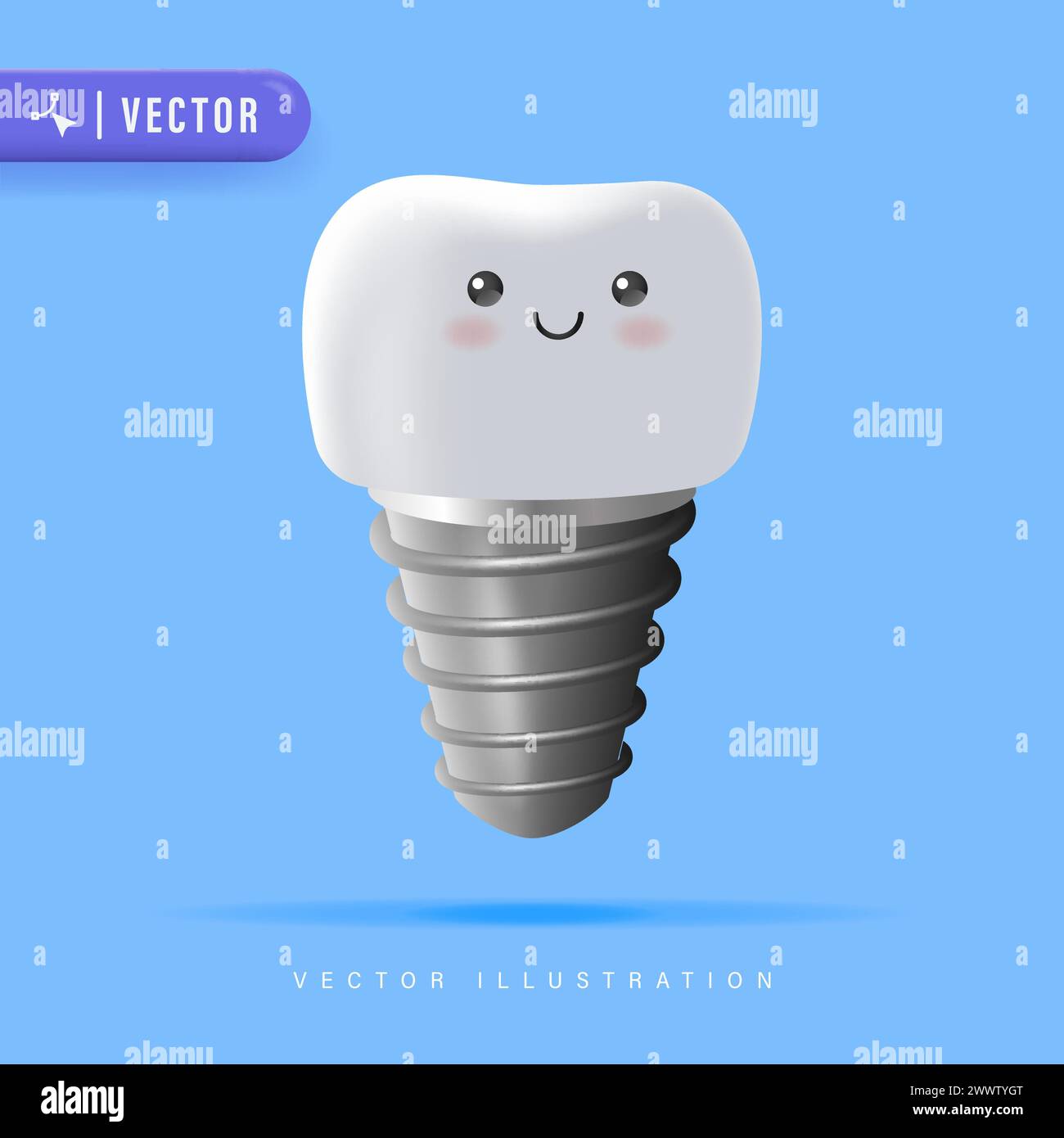 Dental Implant Vector Illustration. Orthopedic Treatment Modern Method ...