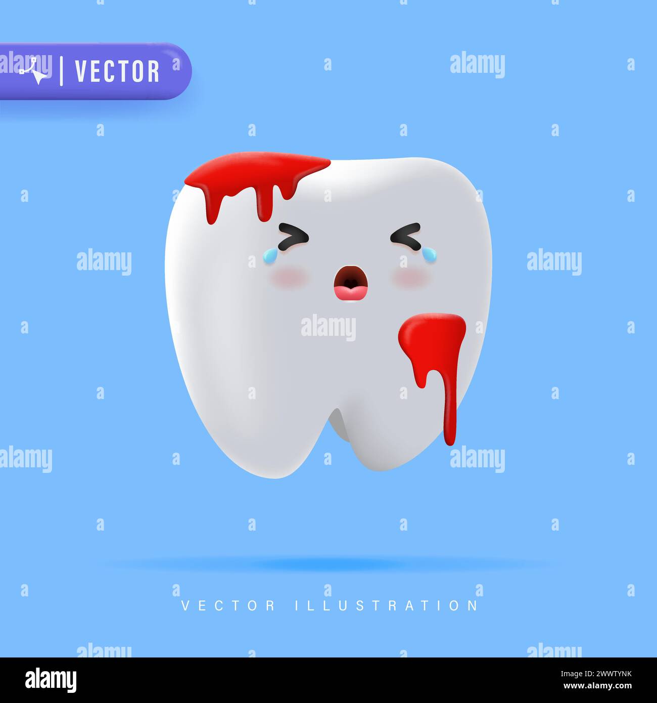 3D Realistic Bleeding Teeth Vector Illustration. Suitable for Children ...