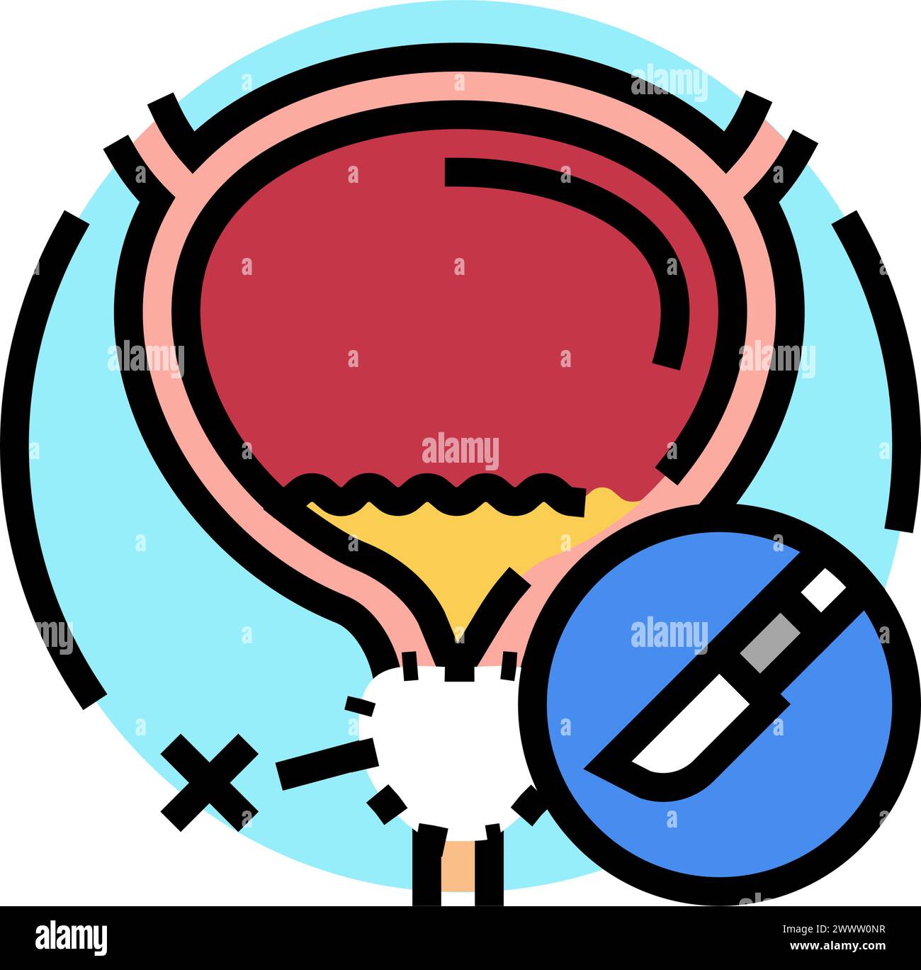 prostatectomy urology color icon vector illustration Stock Vector Image ...