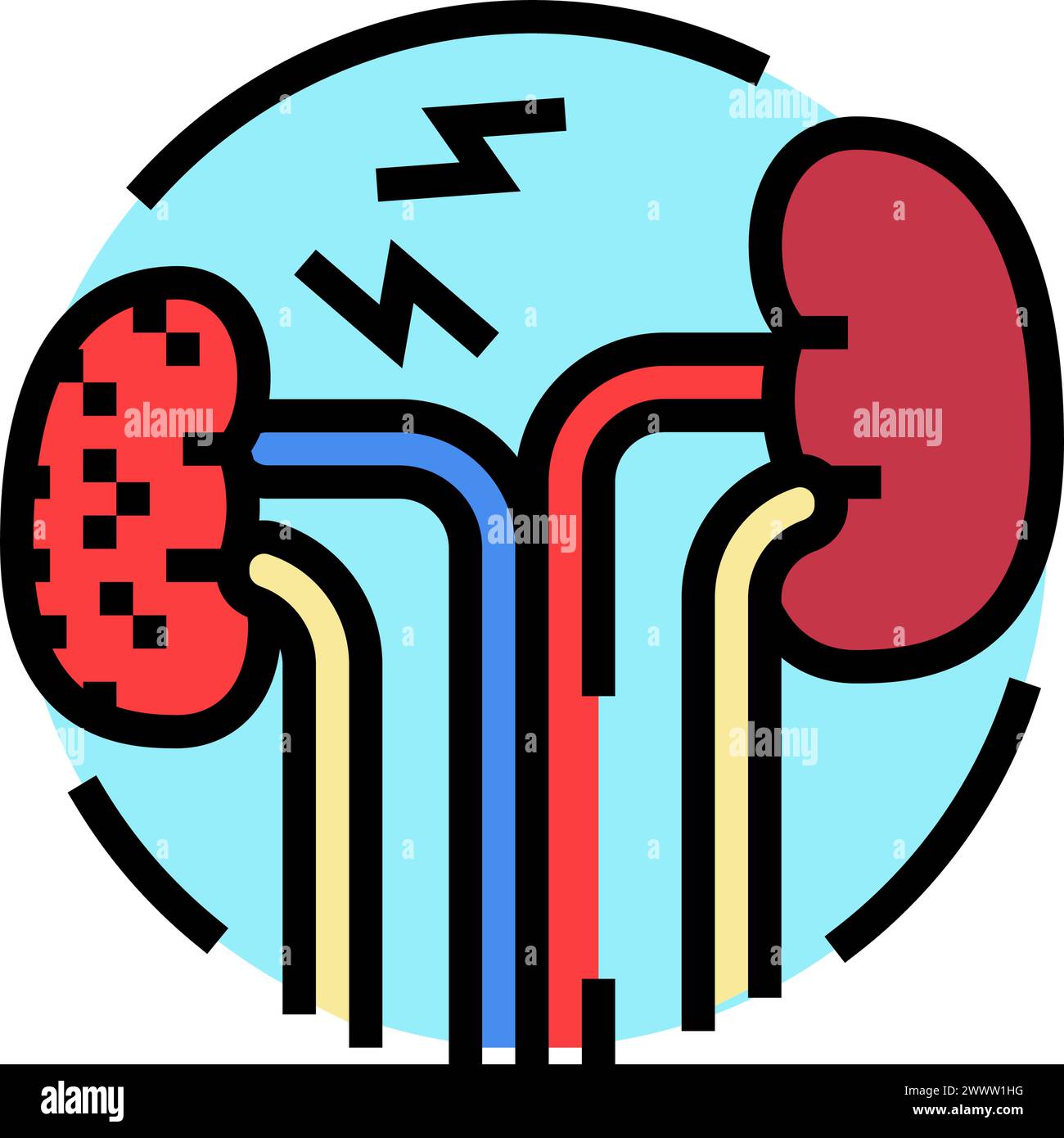 renal failure urology color icon vector illustration Stock Vector Image ...