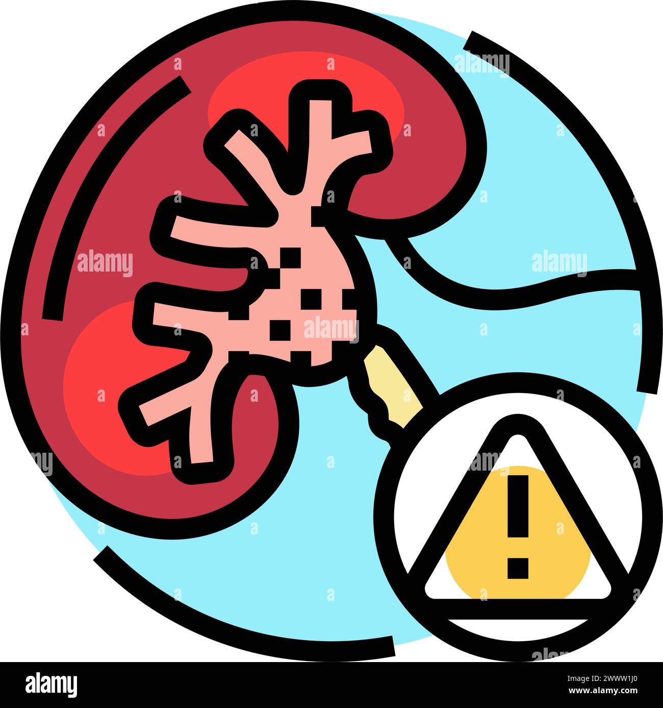 Hydronephrosis Urology Color Icon Vector Illustration Stock Vector