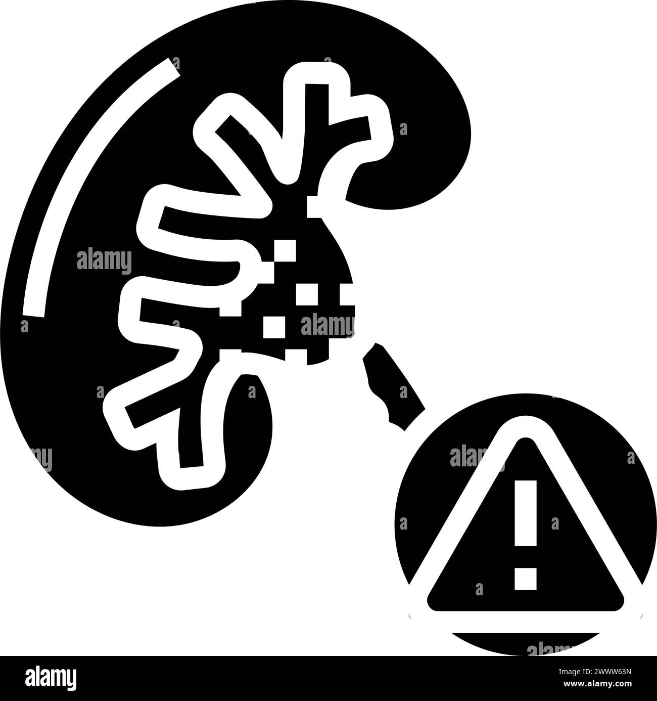 Hydronephrosis Urology Glyph Icon Vector Illustration Stock Vector
