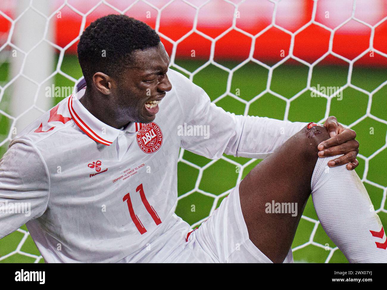 Denmark's Mohamed Daramy is injured with his knee during the friendly ...