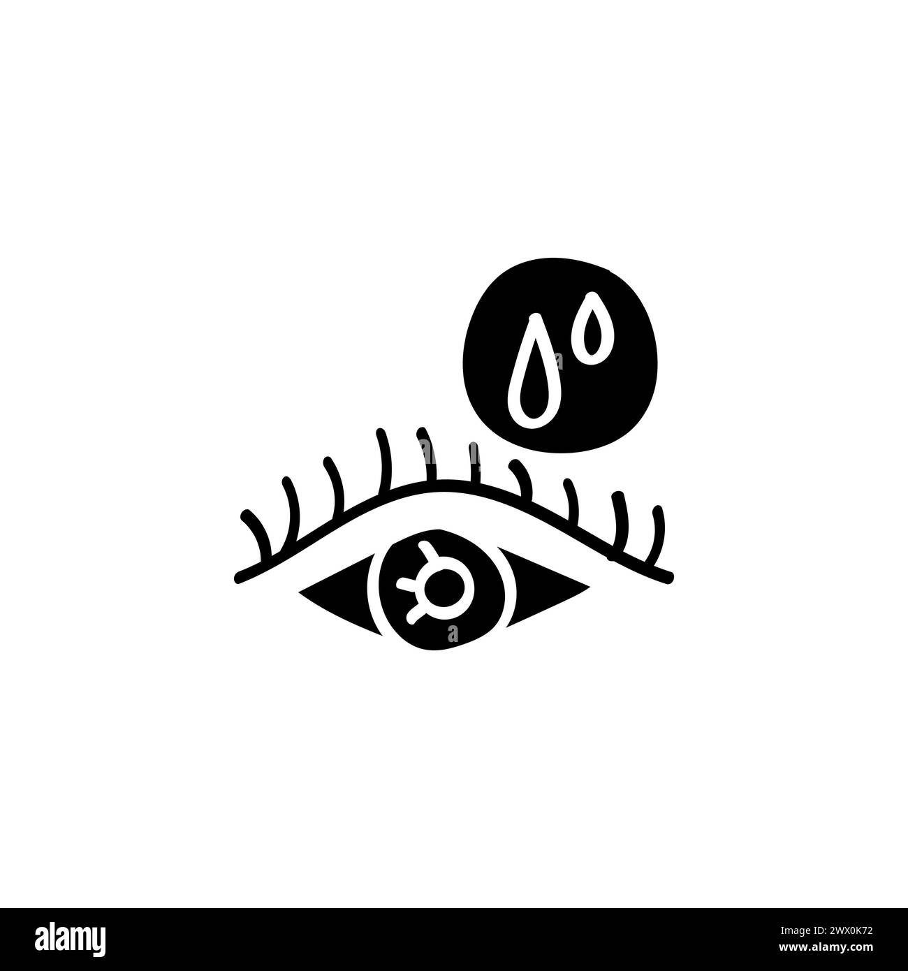 Conjunctivitis eyes Black and White Stock Photos & Images - Alamy