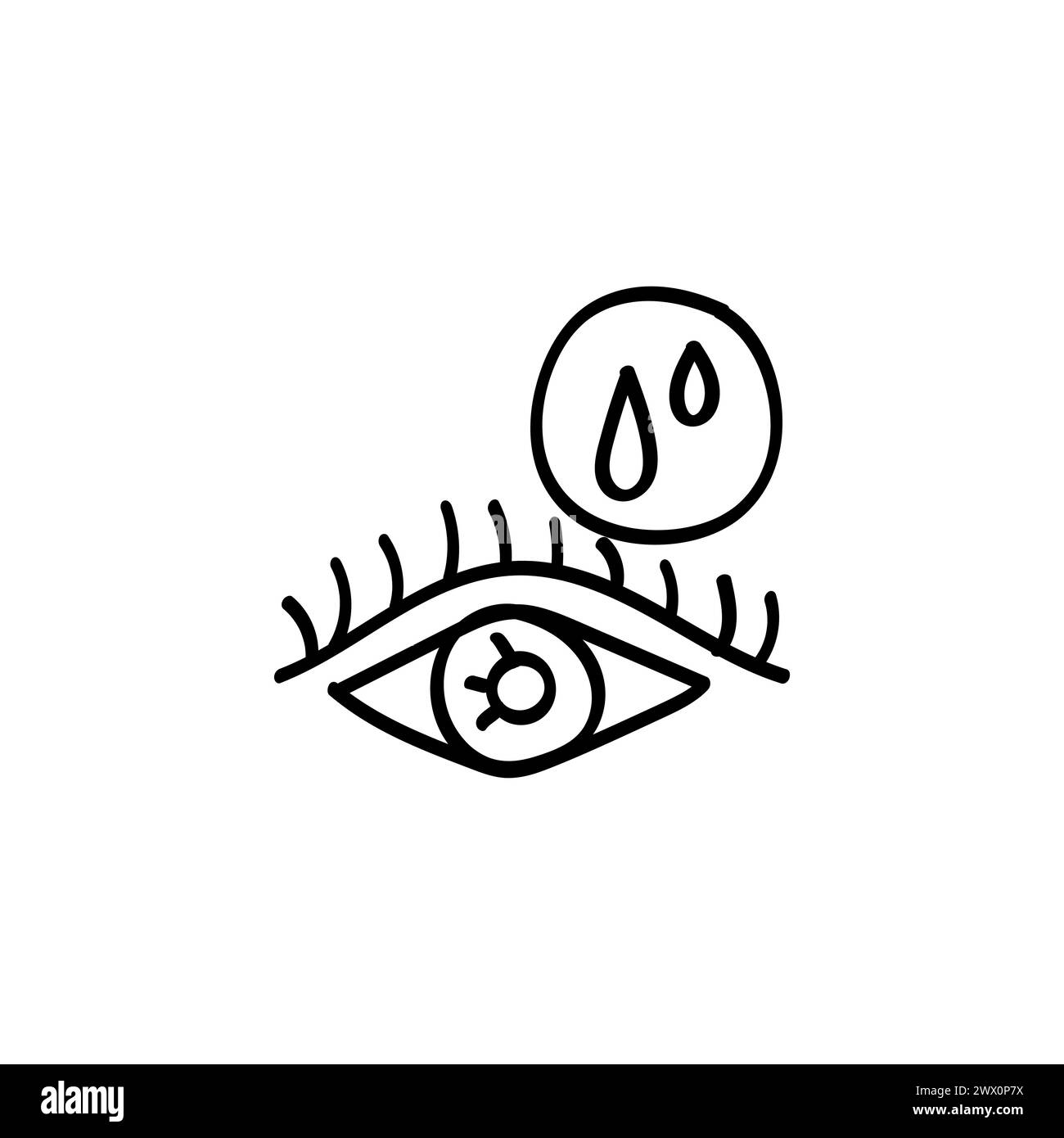 Eye allergic reaction Stock Vector Images - Alamy