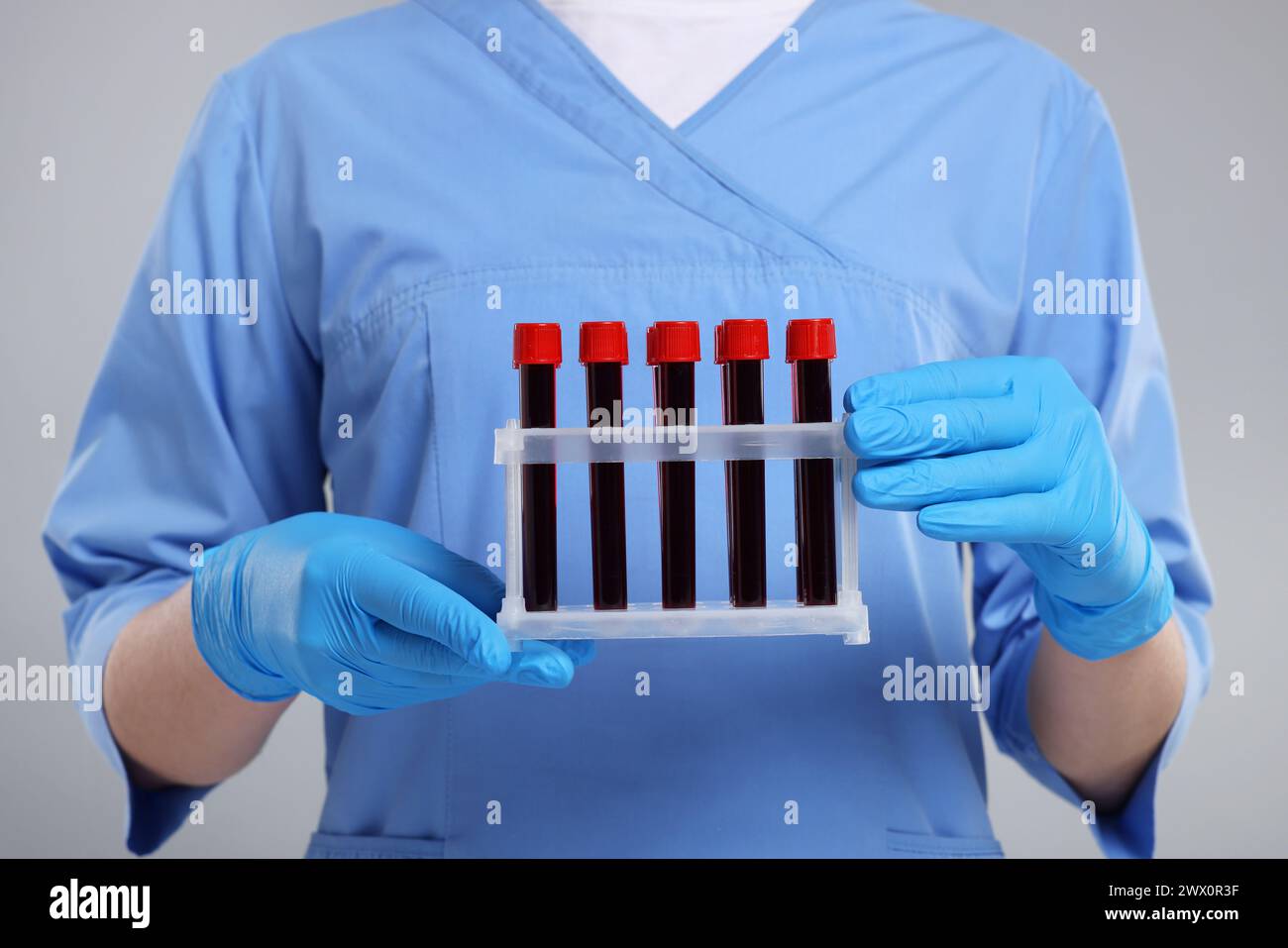 Laboratory testing. Doctor with blood samples in tubes on light grey ...