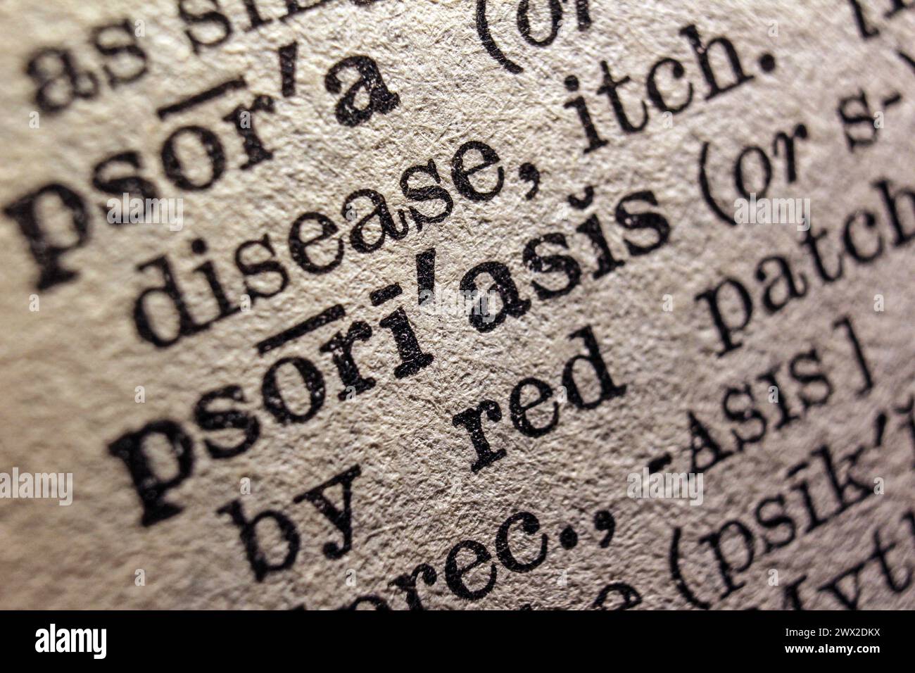 Psoriasis word hi-res stock photography and images - Alamy