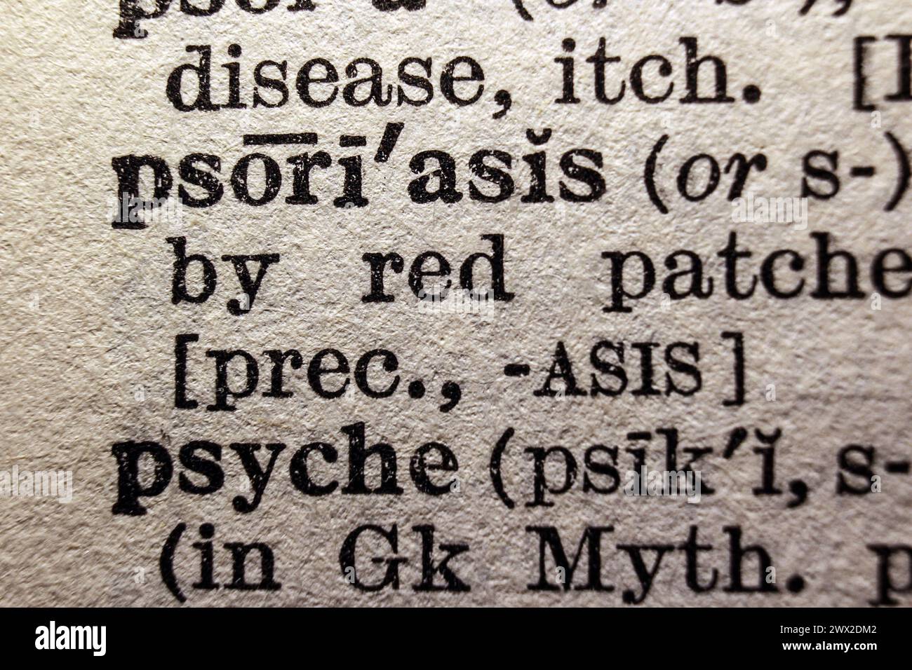 Psoriasis word hi-res stock photography and images - Alamy