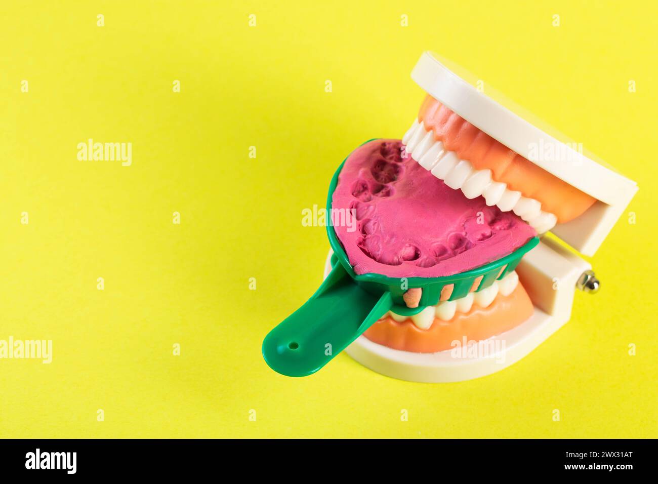 Green dental spoon for taking a dental impression in a mock-up of a ...