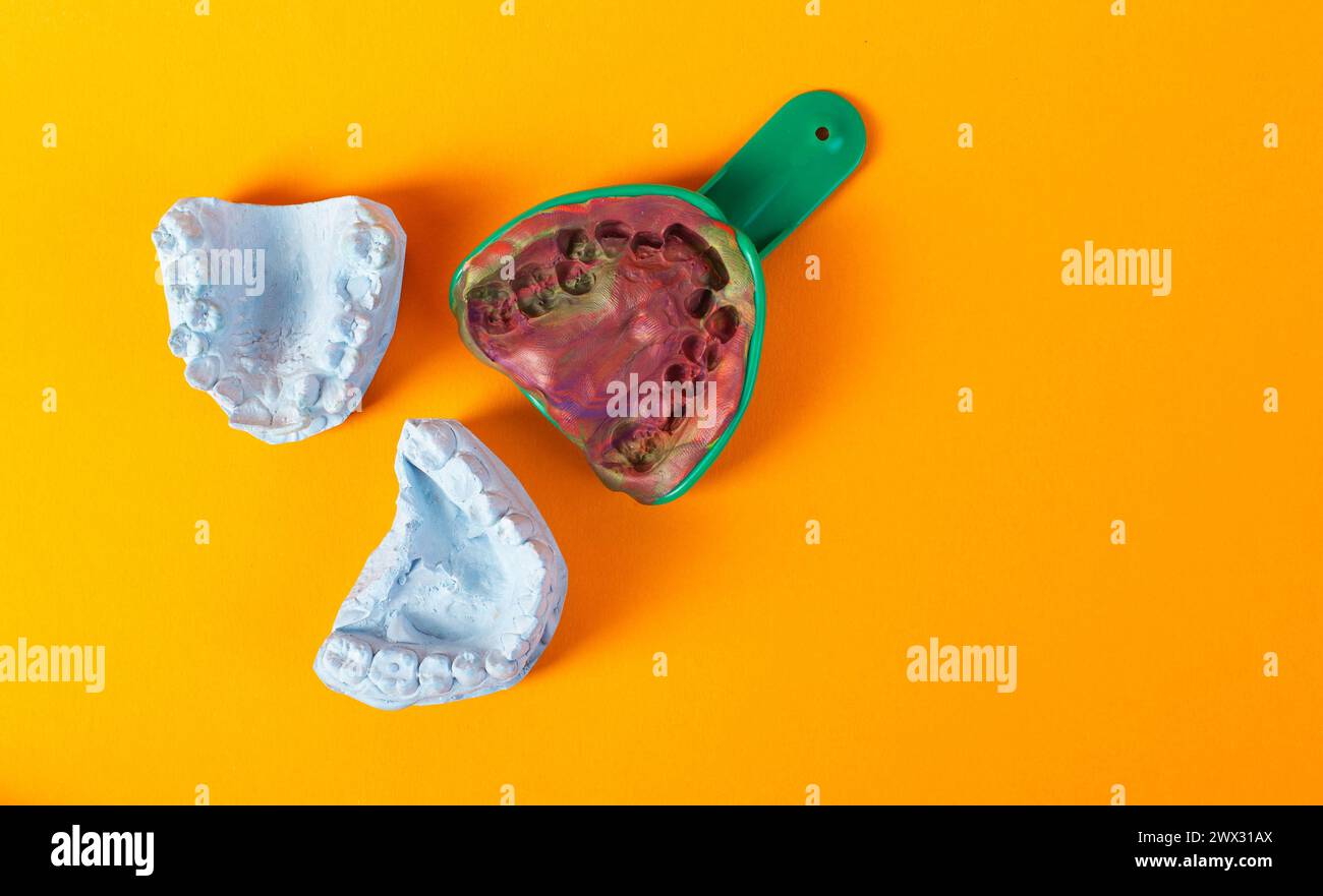 Blue plaster cast of a dental jaw and a dental tray for an impression ...