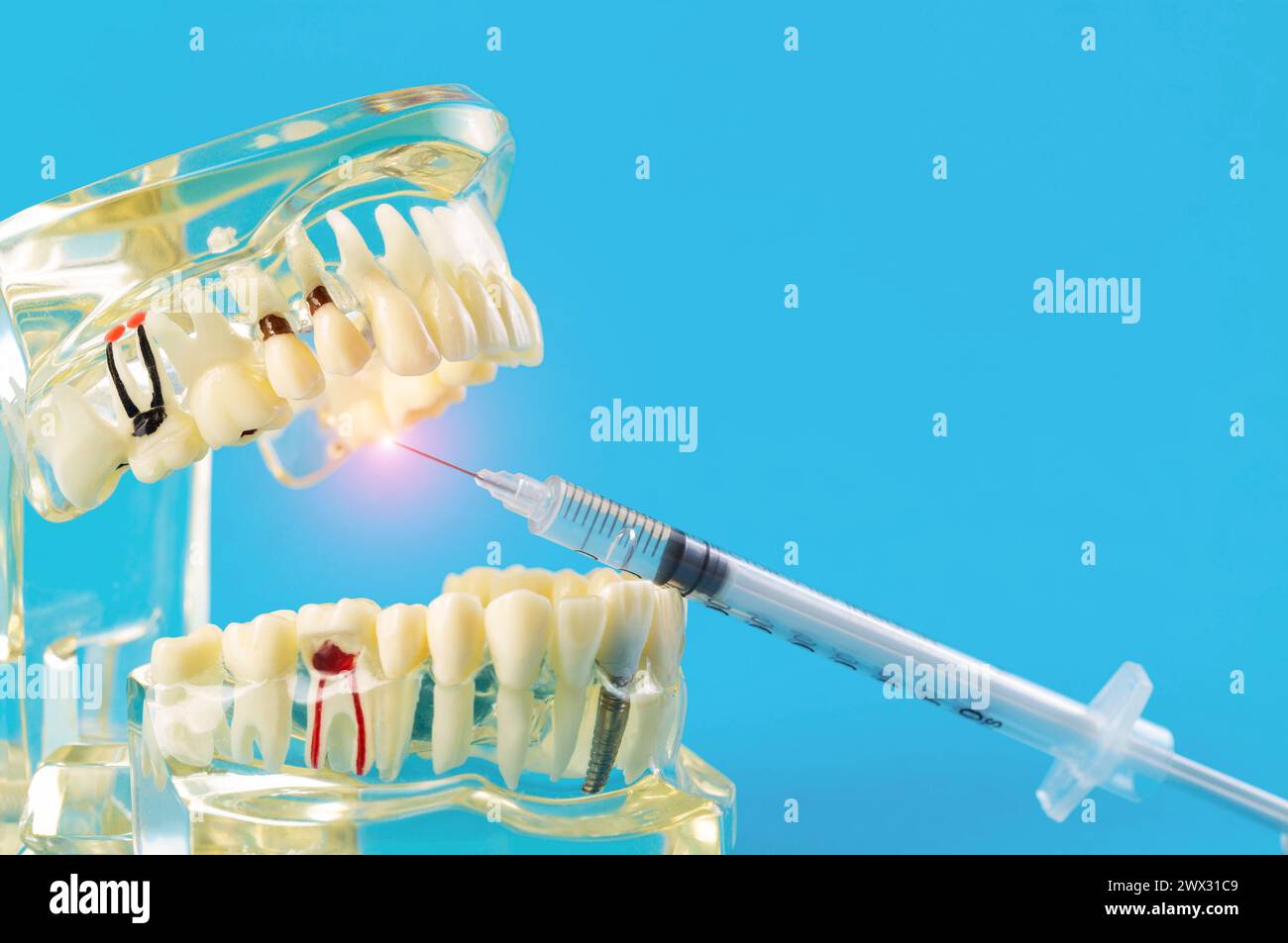 A Syringe With An Anesthetic Anesthetic Drug Makes An Injection Into An