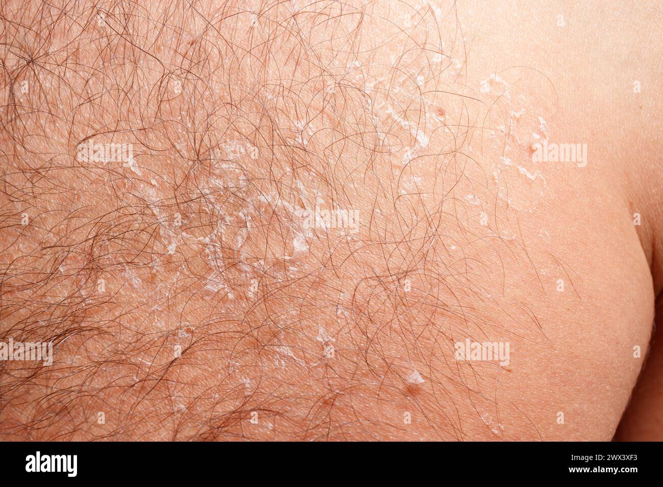 Chest after hi-res stock photography and images - Alamy