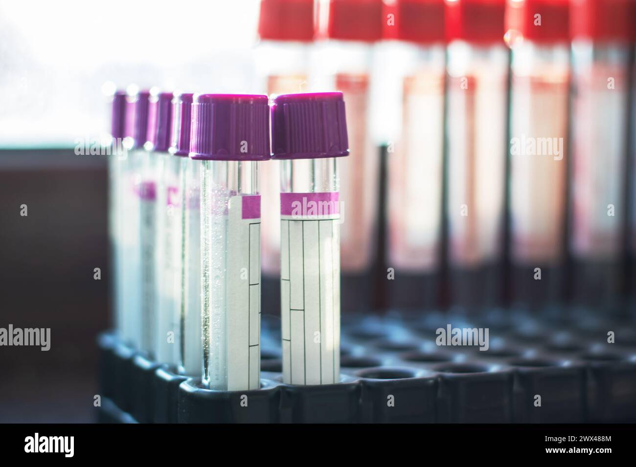 Tubes stand hi-res stock photography and images - Alamy